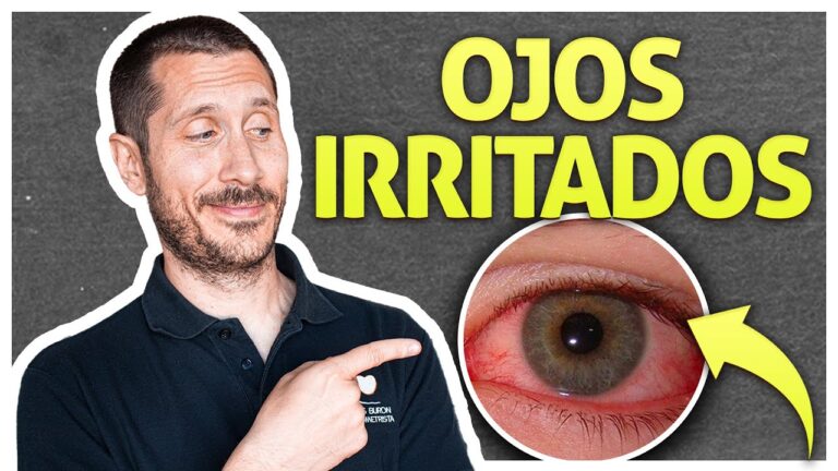 5 Claves Para Aliviar La Irritación Ocular – ABSHE